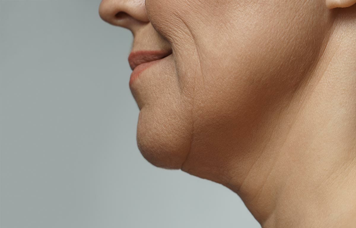 Weak Jawline | Allura Skin, Laser & Wellness Clinic | Fort Collins ...